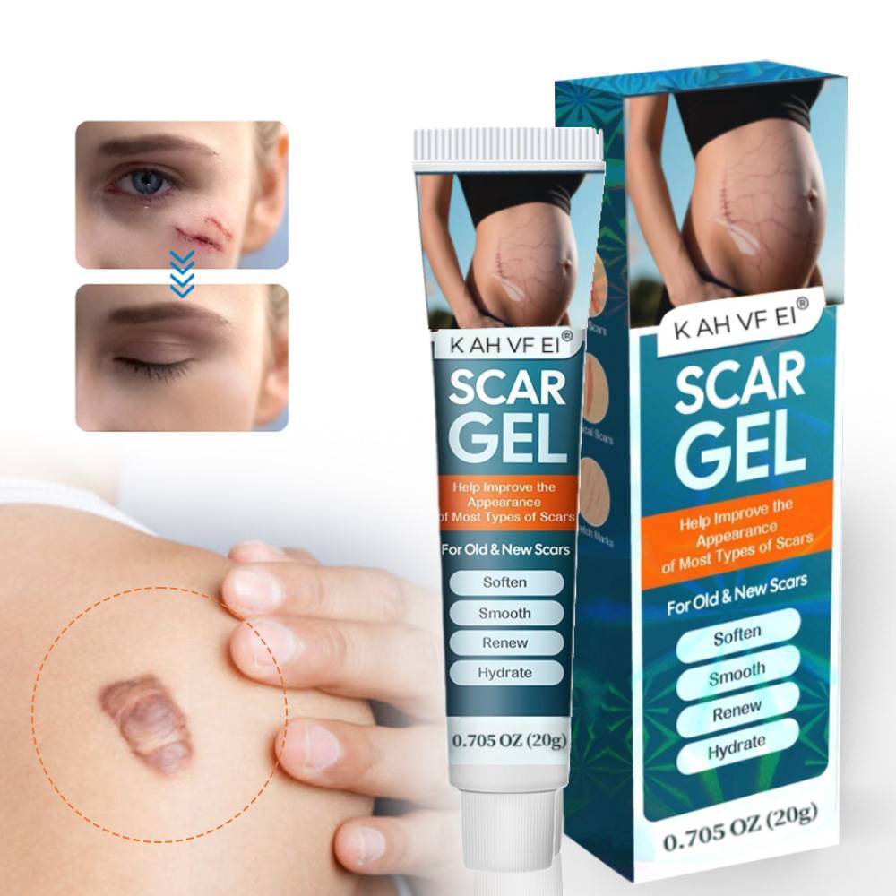 Jual Obat Penghilang Bekas Luka Lama Hitam Koreng Bakar Knalpot Jerawat ...