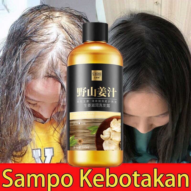 Jual Ginger Shampoo 300ml Anti rambut rontok Botak shampo penumbuh rambut sampo anti ketombe dan ...