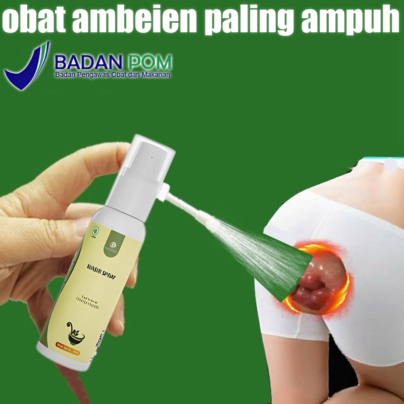 Jual 【BPOM】Salep wasir salep ambeien paling ampuh obat ambeien 30ml ...