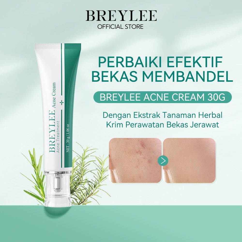 Jual 【BPOM】BREYLEE Acne Scar Removal - BREYLEE Penghilang Noda Bekas Jerawat, Luka & Stretch ...