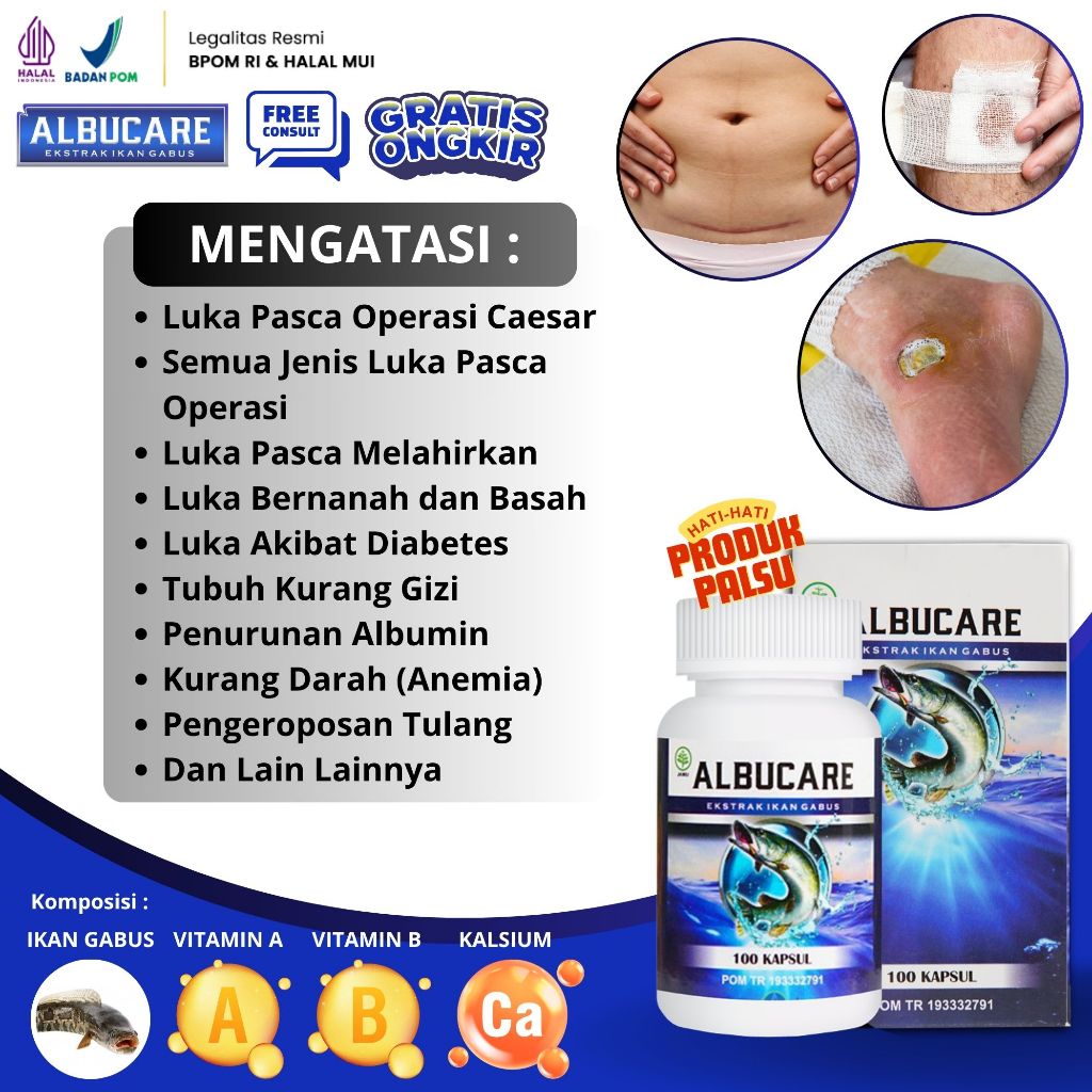 Jual Albucare Kapsul Ekstrak Ikan Gabus Original Berkualitas Premium Tinggi Protein Albumin Ikan ...