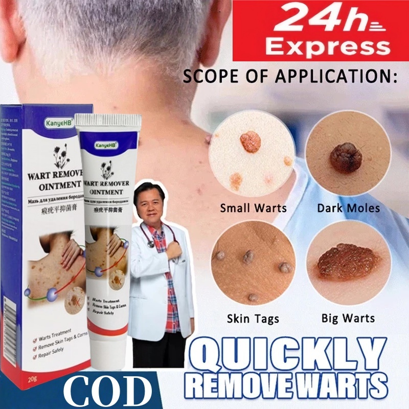 Jual Kanyehb Salep Kutil Paling Ampuh Penghilang Tahi Lalat Di Wajah ...