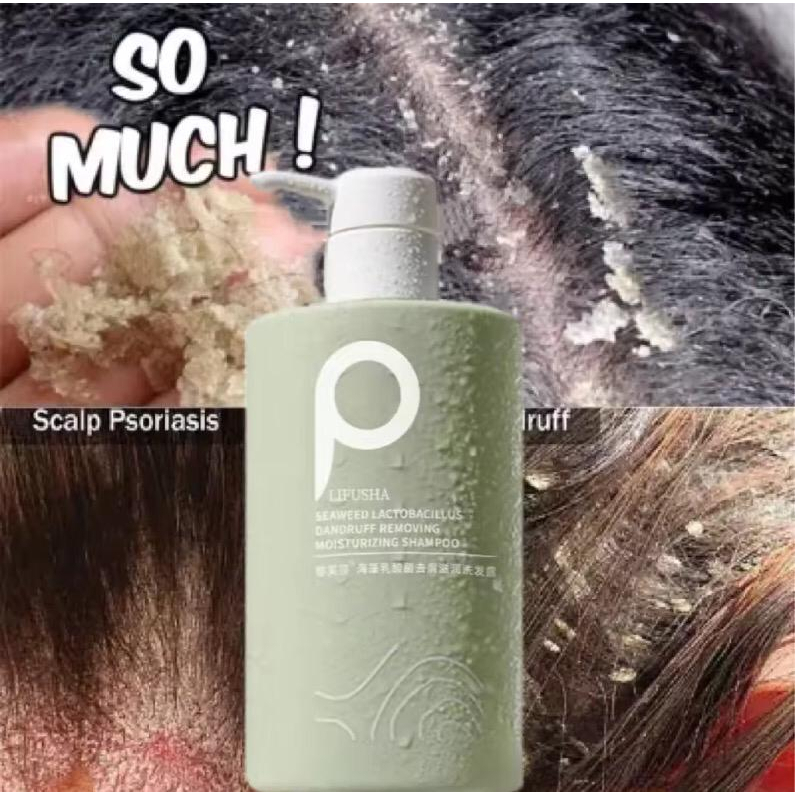 Jual obat ketombe sampo anti ketombe dan gatal shampoo penghilang ketombe sea salt Shampoo Sea ...