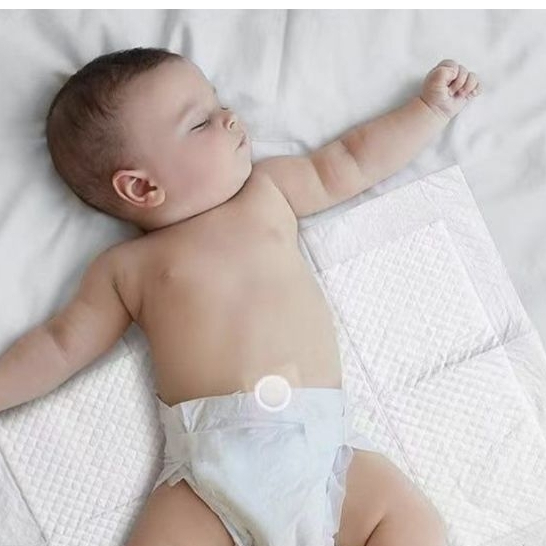 Jual hernia patch umbilical infant Bodong Pusar Bodong Bayi Sachet ...