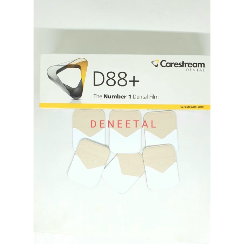 Jual X RAY DENTAL FILM / X-RAY RONTGEN GIGI YES STAR 3cm x 4cm LIGHT ...
