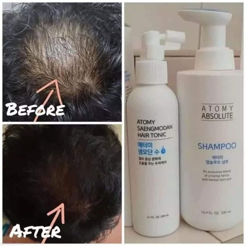 Jual ATOMY SET SHAMPO ABSOLUTE + HAIR TONIC ORIGINAL | Shopee Indonesia