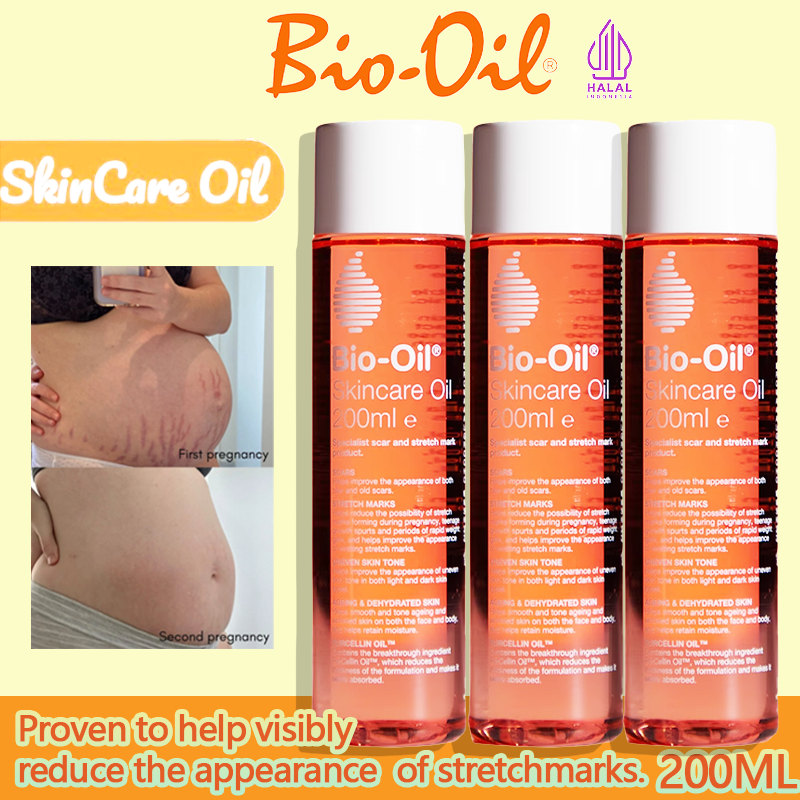 Jual Bio-Oil 3PCS - 200ML -Skincare / Penghilang Bekas Luka / Stretch ...