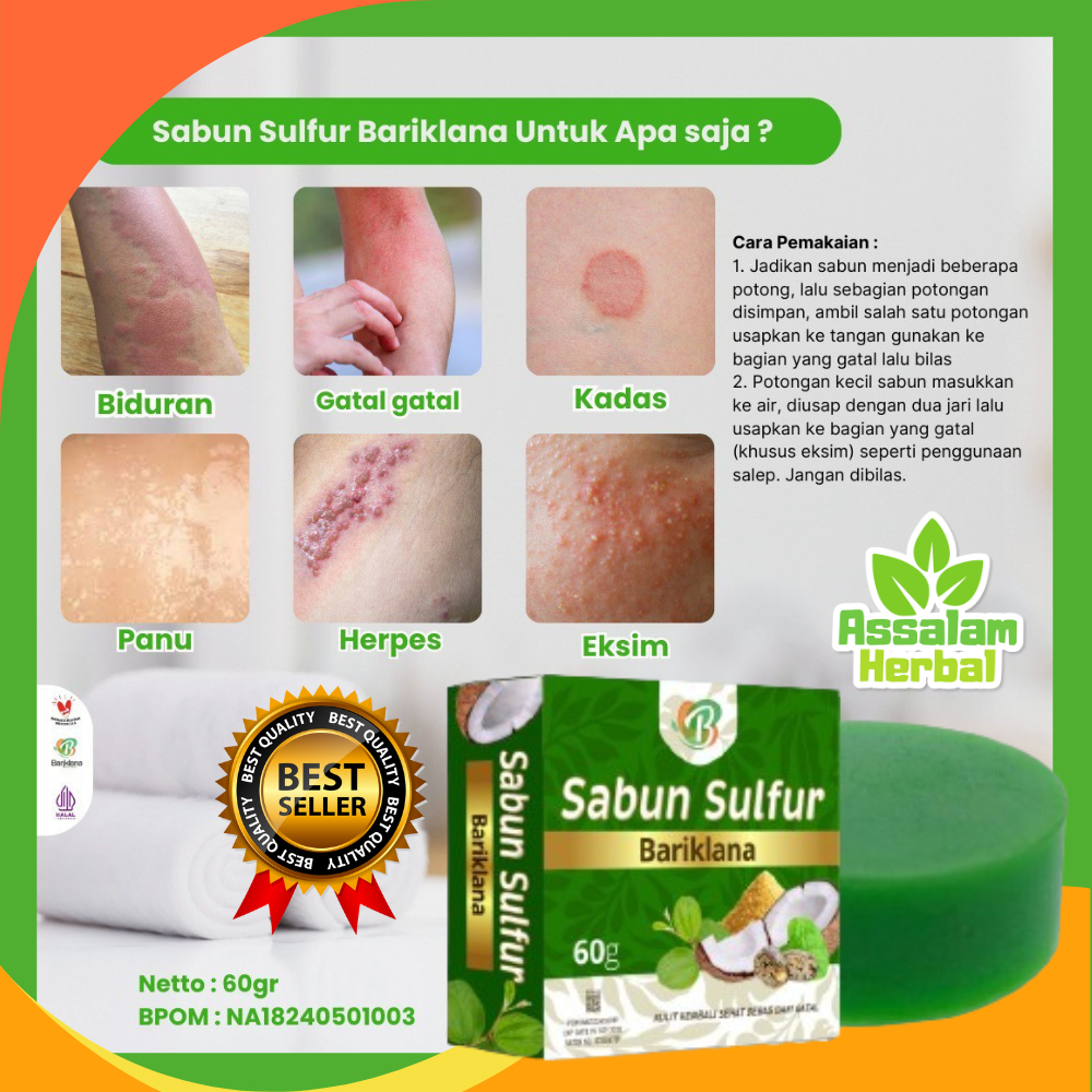 Jual SABUN SULFUR Sabun Gatal Eksim Scabies Panu Kadas Kurap dan ...