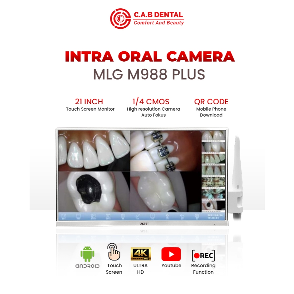 Jual INTRA ORAL CAMERA MLG M988 PLUS / IOC CAMERA DENTAL ANDROID TV ...