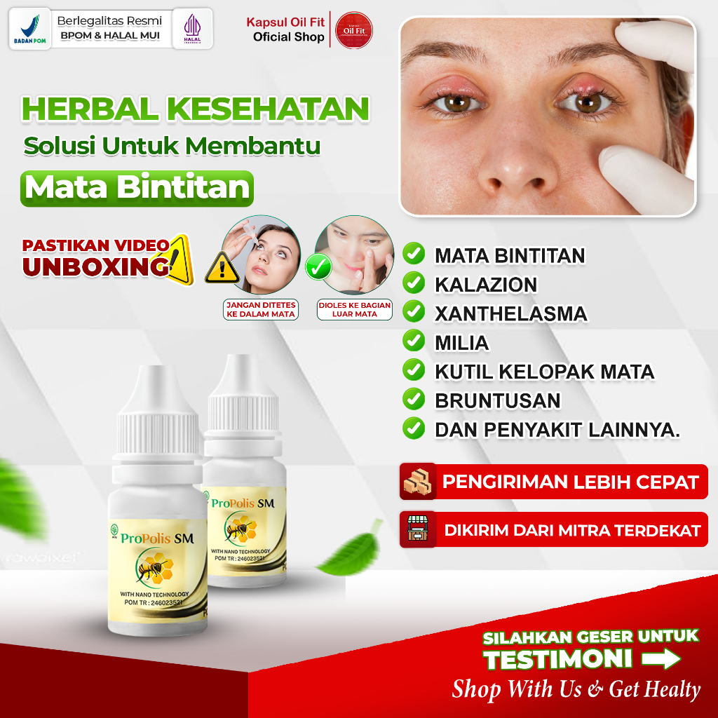 Jual Obat Mata Bintitan Luar Mata Kalazion Anak dan Dewasa Benjolan Di ...