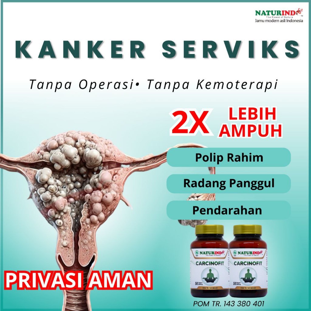 Jual Obat Kanker Serviks Leher Rahim Tumor Polip Rahim Herbal Alami ...