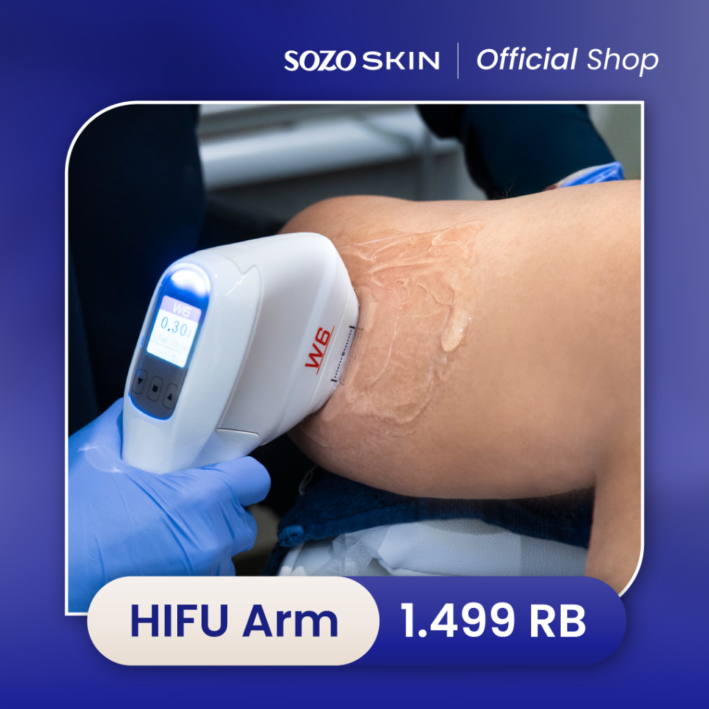 Jual SOZO SKIN HIFU Arm | Shopee Indonesia