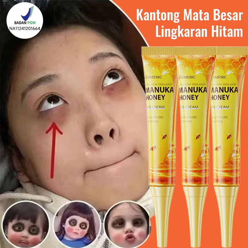 Jual Eye Cream Mata Panda 20g Mata untuk Lingkaran Hitam Bengkak ...