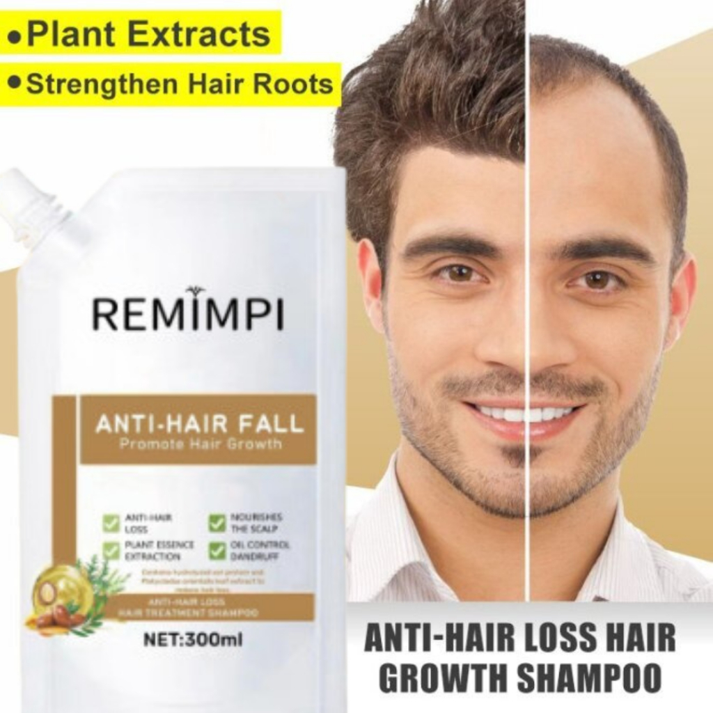 Jual Remimpi Hair Loss Treatment Shampoo - 300ml Shampo Penumbuh Rambut ...