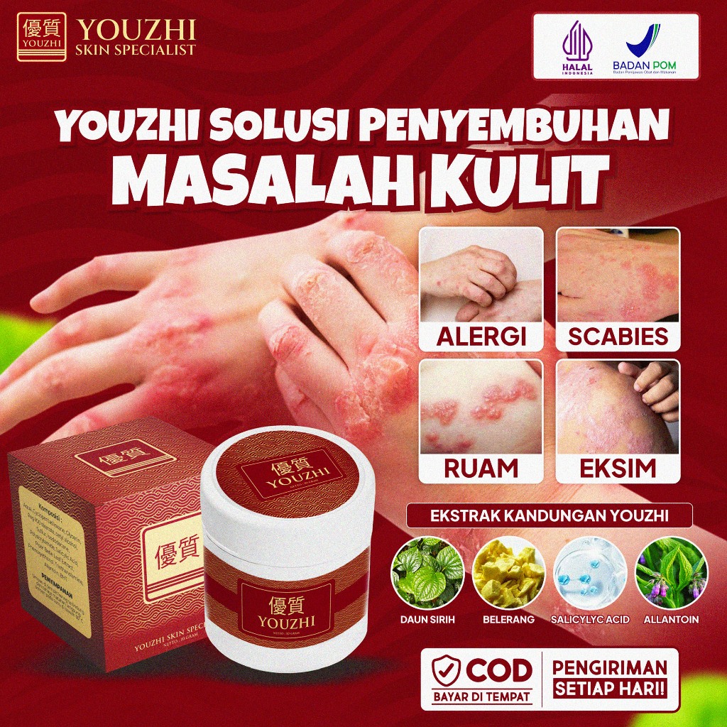 Jual SALEP YOUZHI MEMBANTU MENGATASI GATAL, EKSIM, ALERGI KULIT ...