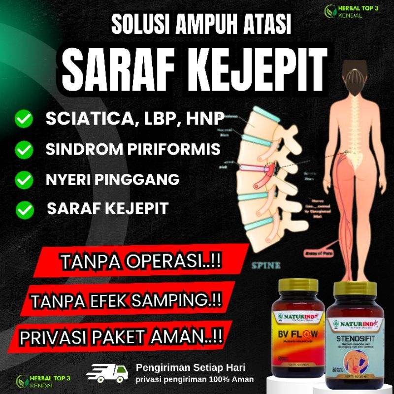 Jual Sciatica Obat Sakit Pinggang Sampai Kaki Sakit Bokong Saraf Kejepit Skiatika | Shopee Indonesia