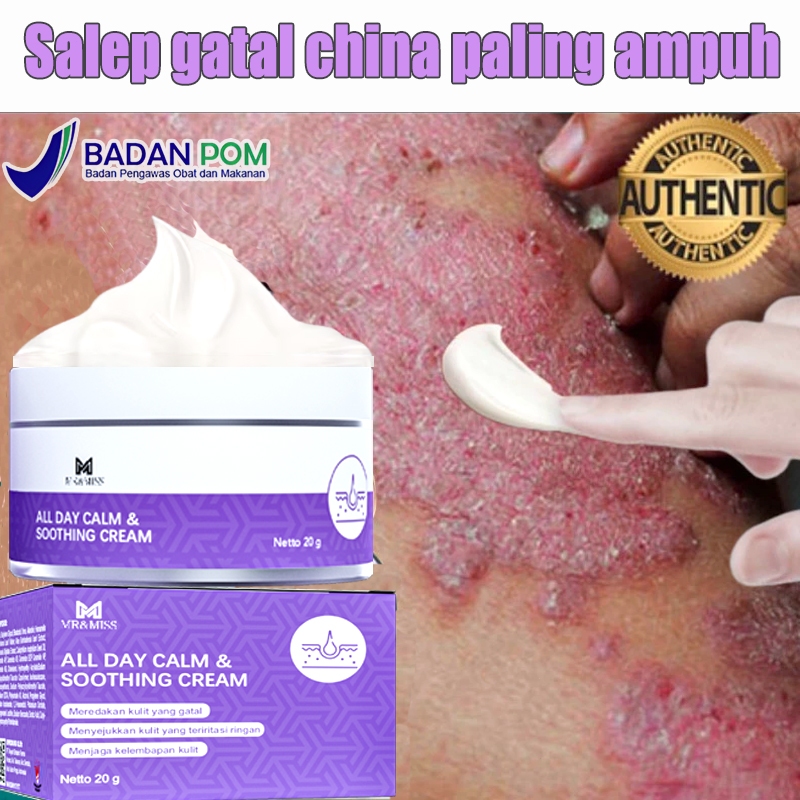 Jual Salep gatal kulit yang ampuh Salep gatel Obat gatal selangkangan ...