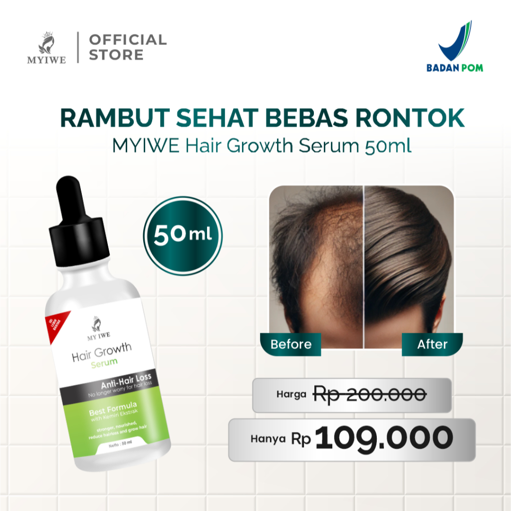 Jual Myiwe Hair Growth Serum Penumbuh Rambut dan Perawatan Rambut ...