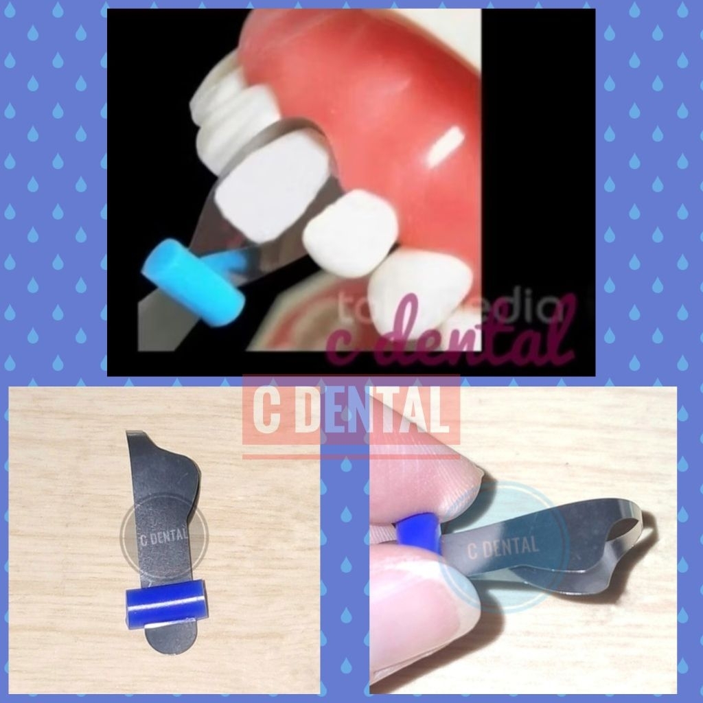 Jual [1 Piece] Dental Anterior Proximal Twins Matrix With Locking Wedge ...