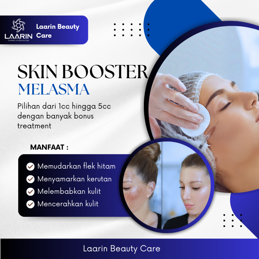 Jual SKIN BOOSTER MELASMA 1CC HINGGA 5CC FULL FACE + NECK | Shopee ...