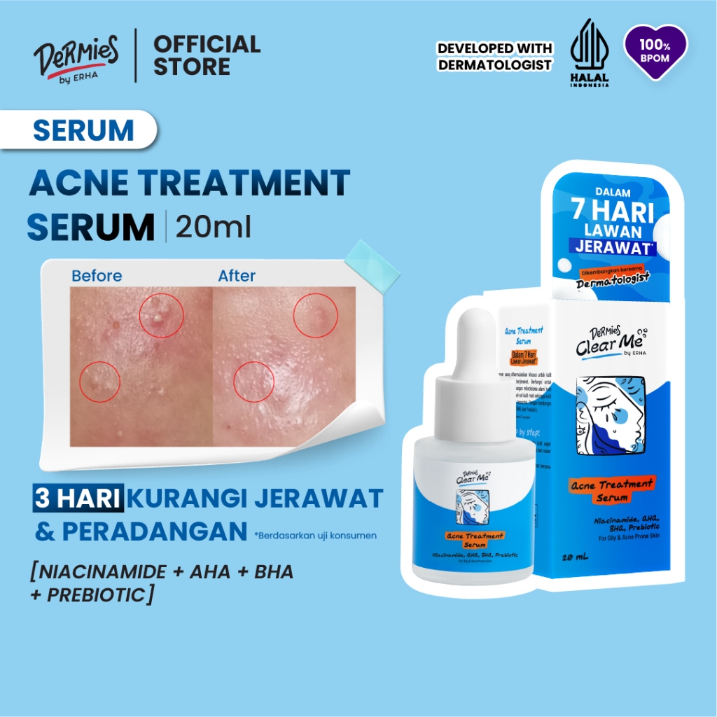 Jual DERMIES Clear Me Acne Treatment Serum 20ml | Shopee Indonesia