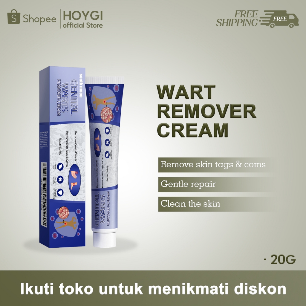 Jual South Moon Wart Removal Cream 20g Lalat Krim Penghilang Kutil dan ...