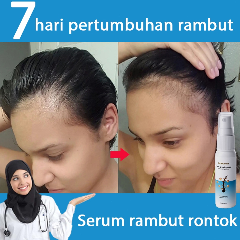 Jual Serum rambut rontok hair tonic penumbuh rambut serum penumbuh ...
