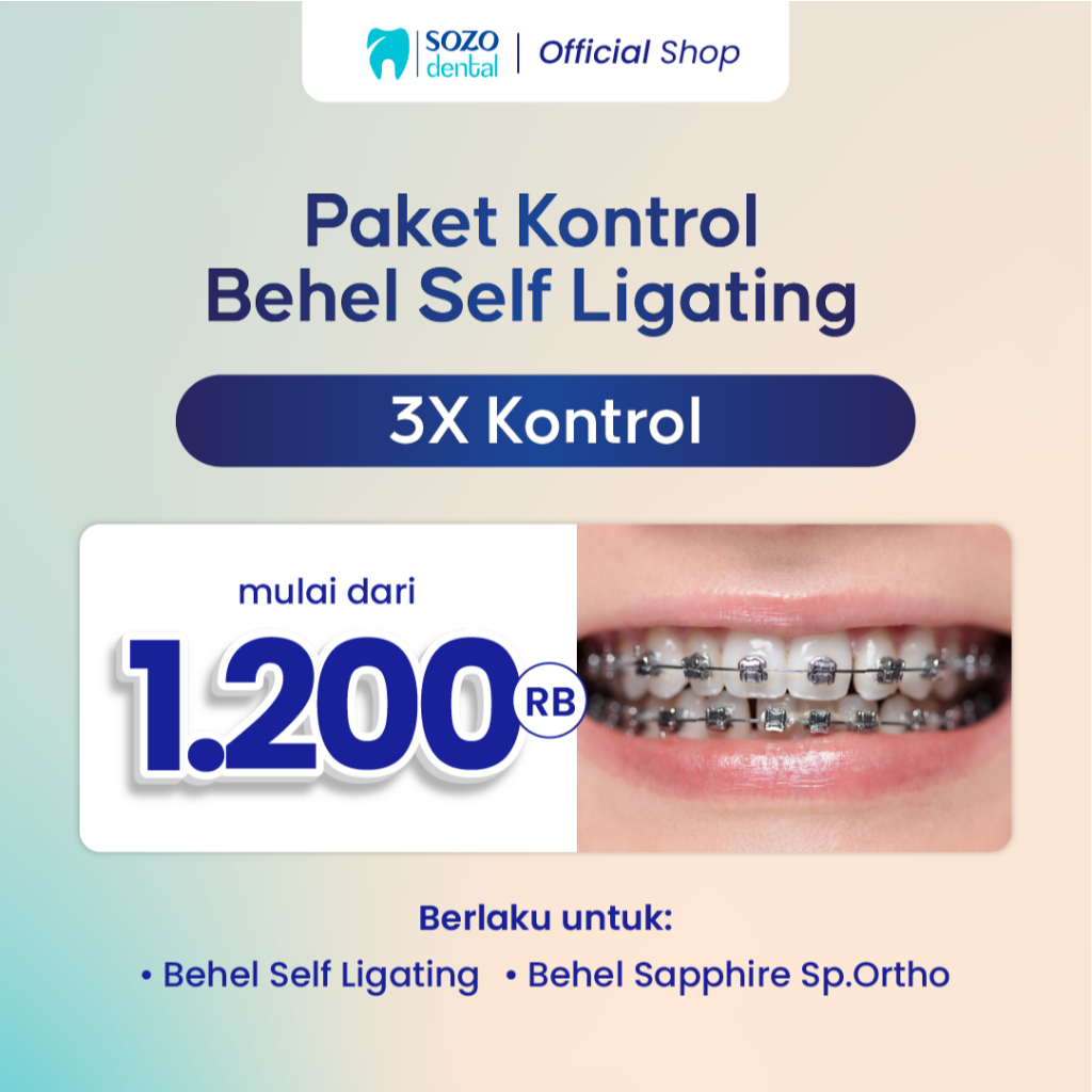 Jual PAKET 3x Voucher Kontrol Behel Self Ligating [Khusus Pasien Behel ...