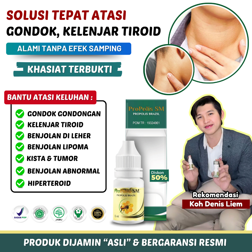 Jual Obat Gondok Tiroid Kelenjar Getah Bening Benjolan di Leher Menahun ...