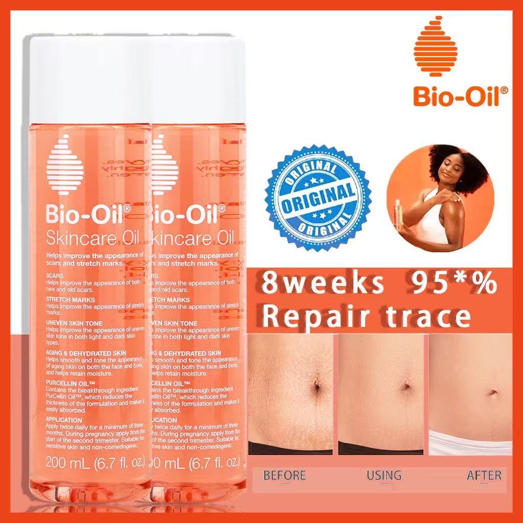 Jual Bio-Oil Skincare Oil 200ml Natural Penghilang Bekas Luka Stretch ...