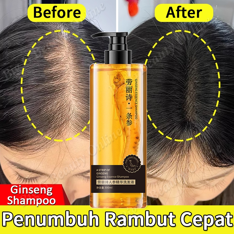 Jual Ginseng Shampoo Penumbuh Rambut Cepat Rambut Rontok Penumbuh ...