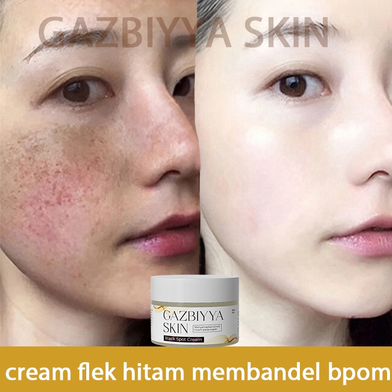 Jual 【BPOM】Cream penghilang flek hitam menghilangkan flek hitam di wajah cream flek hitam ...