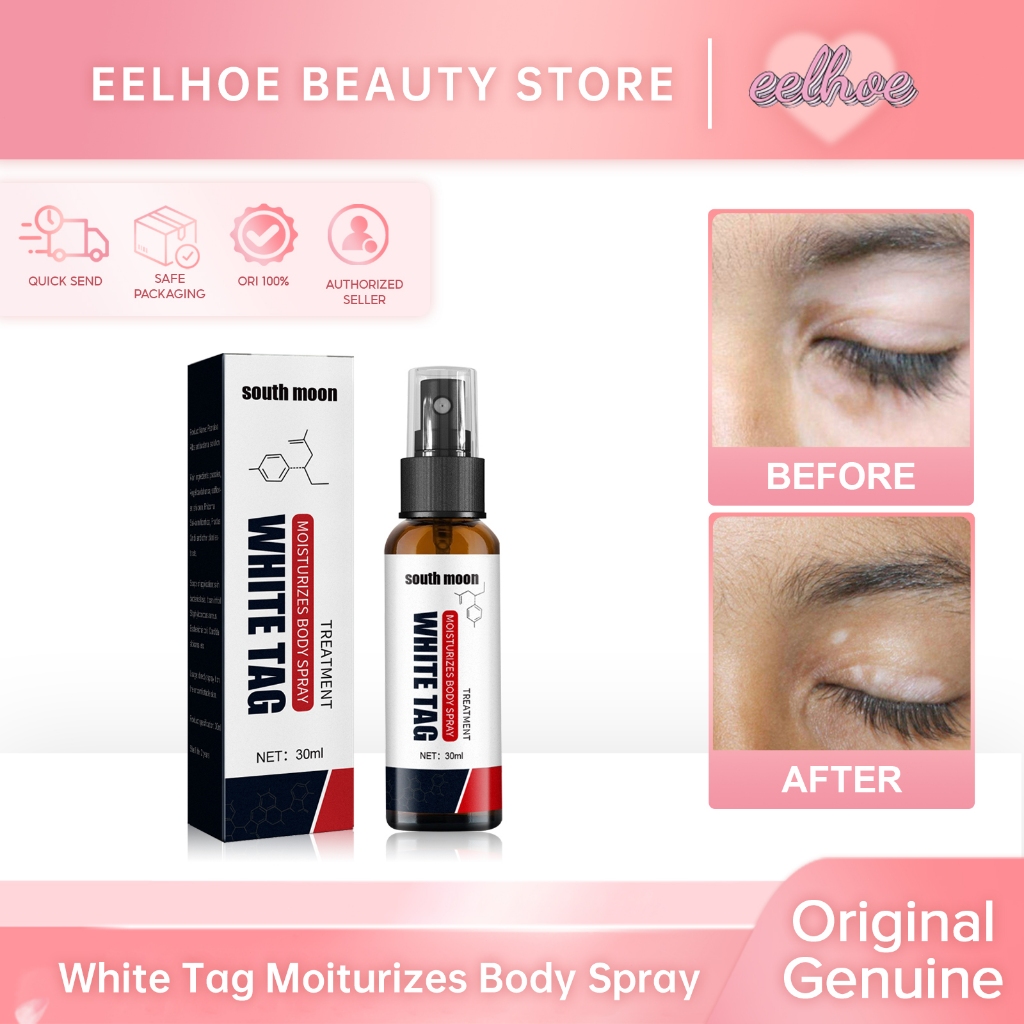 Jual South Moon White Tag Removal Spray/Melanin Repair White Spot Mild ...