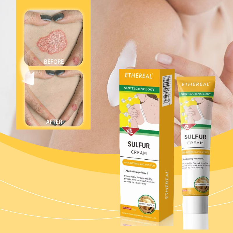 Jual anti gatal krim multifungsi Salep gatal paling ampuh 20g | Atasi ...