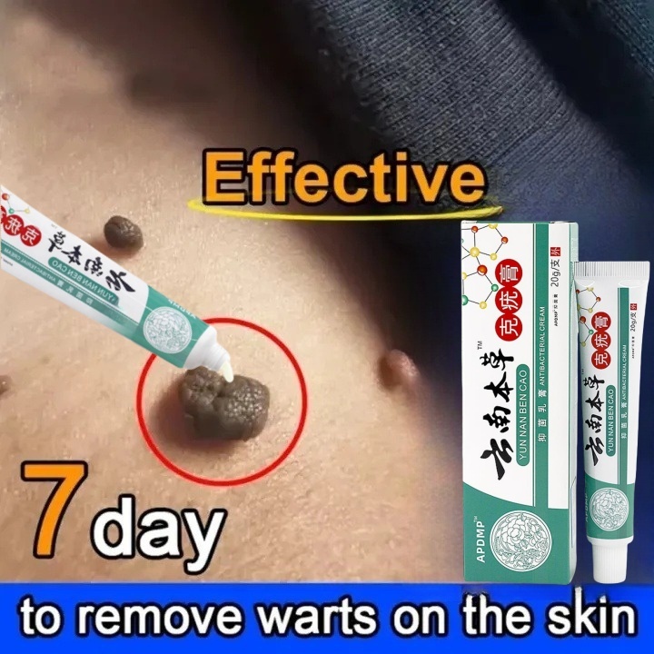 Jual 100% Asli Penghilang Tahi Lalat Penghilang Kutil Skin Tag Remover ...