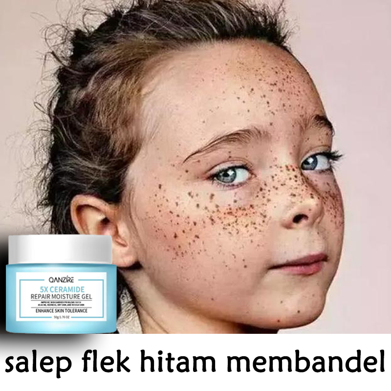 Jual Krim penghilang flek hitam cream flek hitam membandel salep flek hitam membandel 50g ...