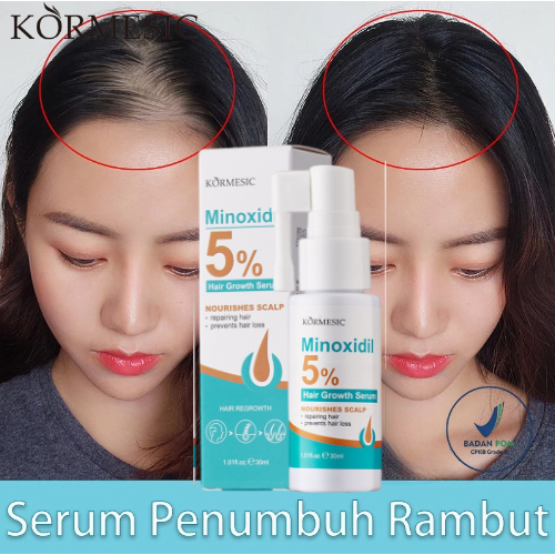 Jual 5% Minoxidil Serum penumbuh rambut Obat penumbuh rambut Penumbuh ...