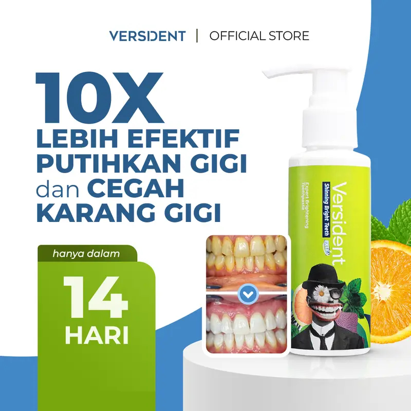 Jual Versident Shinning Bright Teeth - Pemutih Gigi / Cegah Karang Gigi ...