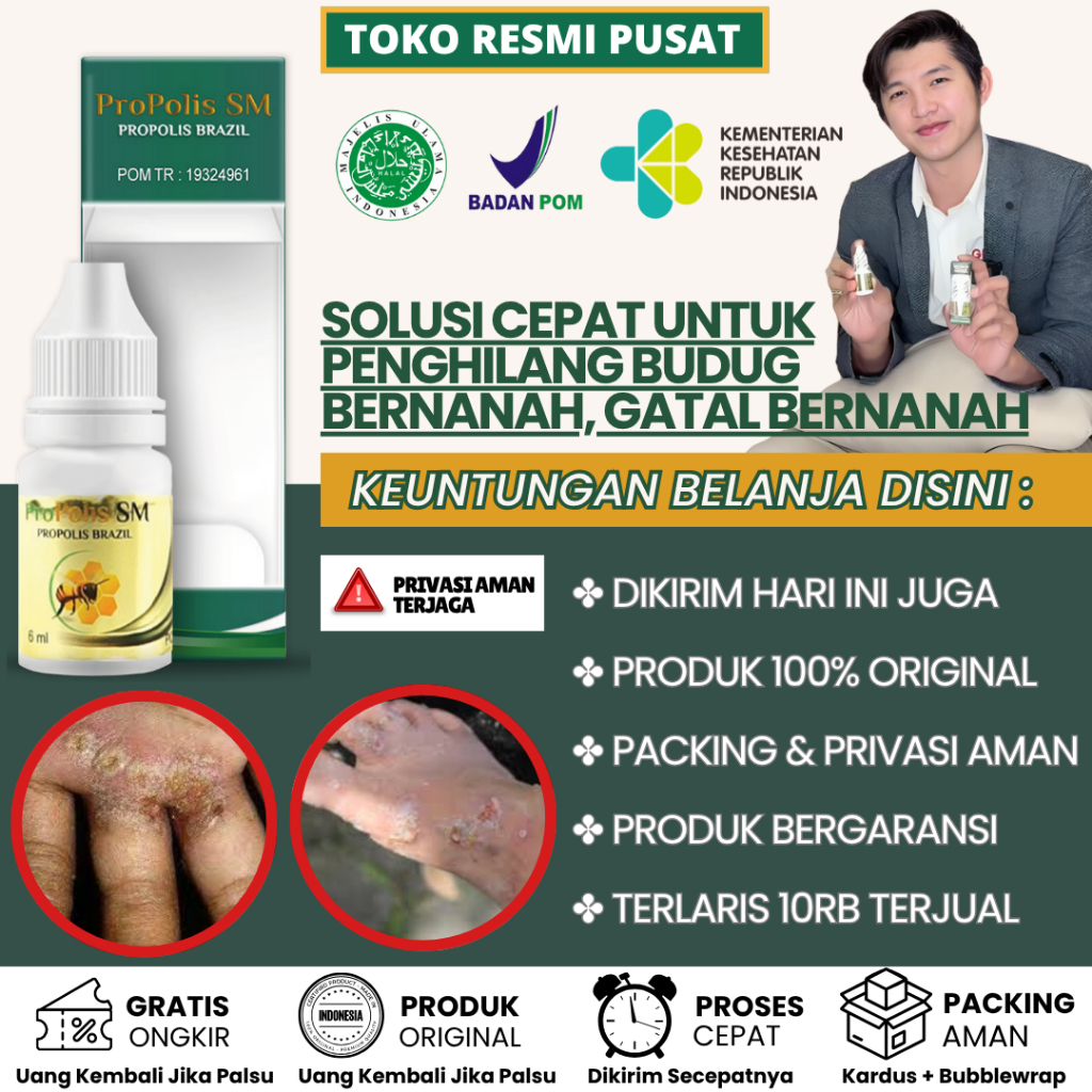 Jual Obat Budug dan gatal, Obat Budug santri, Obat Gudig / Gudik, Obat ...