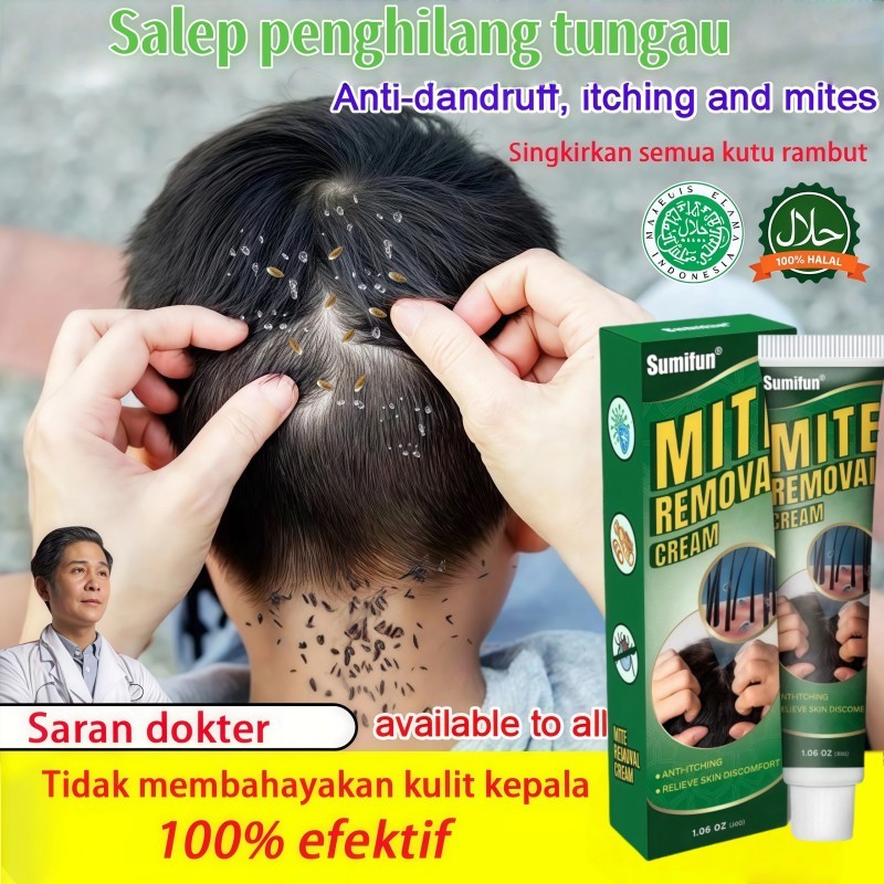 Jual 30g Sumifun Mite Removal Cream Anti-Itching Mite Removal Cream Obat ketombe Seborrheic ...