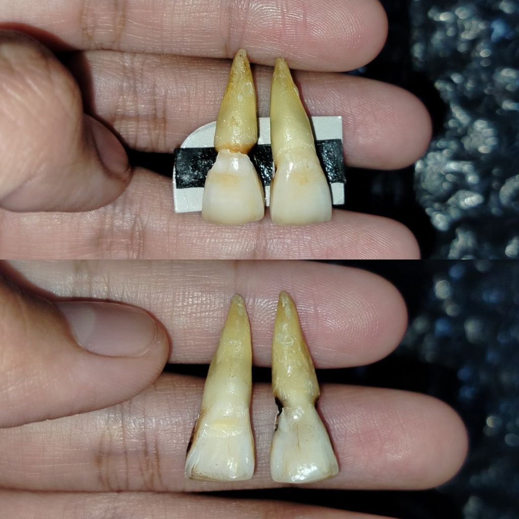 Jual Gigi Insisivus Identik | Shopee Indonesia