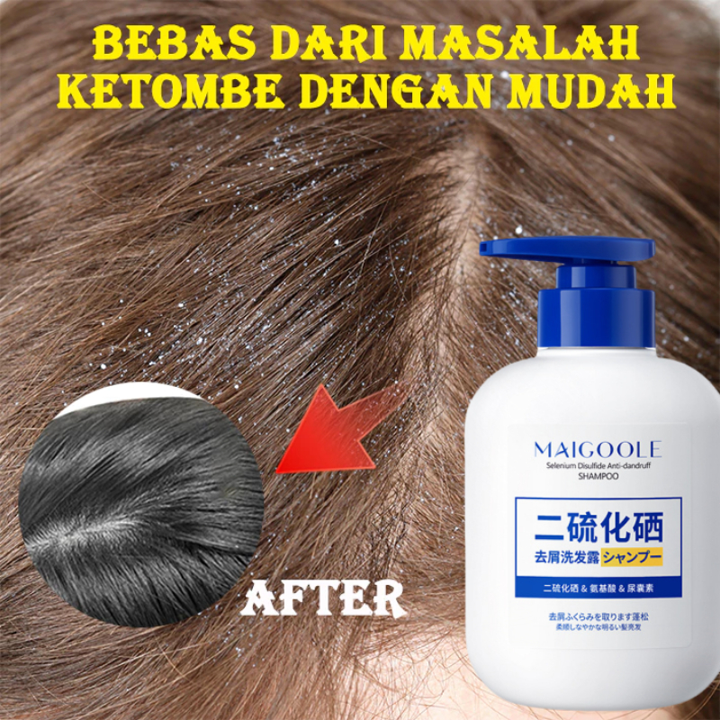 Jual Sampo Anti Ketombe Menghilangkan Ketombe yang Membandel dan Gatal pada Kulit Kepala ...