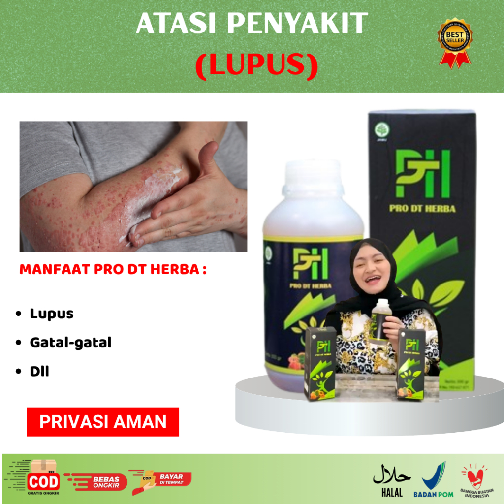 Jual Obat Lupus Autoimun Psoriasis Kulit Ruam Bersisik Eksim Dermatitis ...