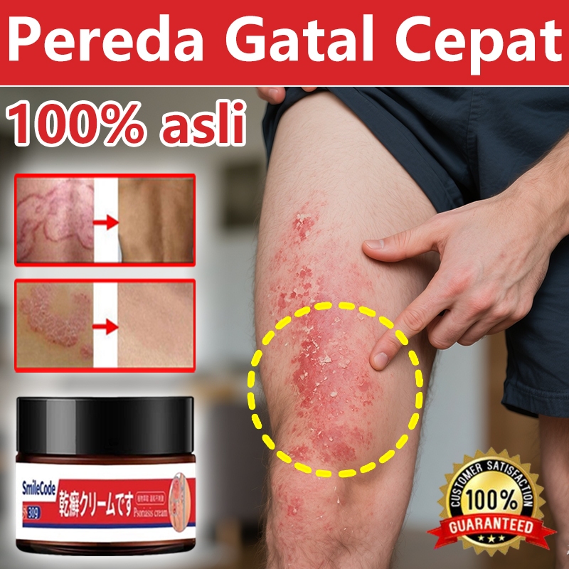 Jual Psoriasis ointment Obat oles infeksi kulit Obat gatal Salep ...