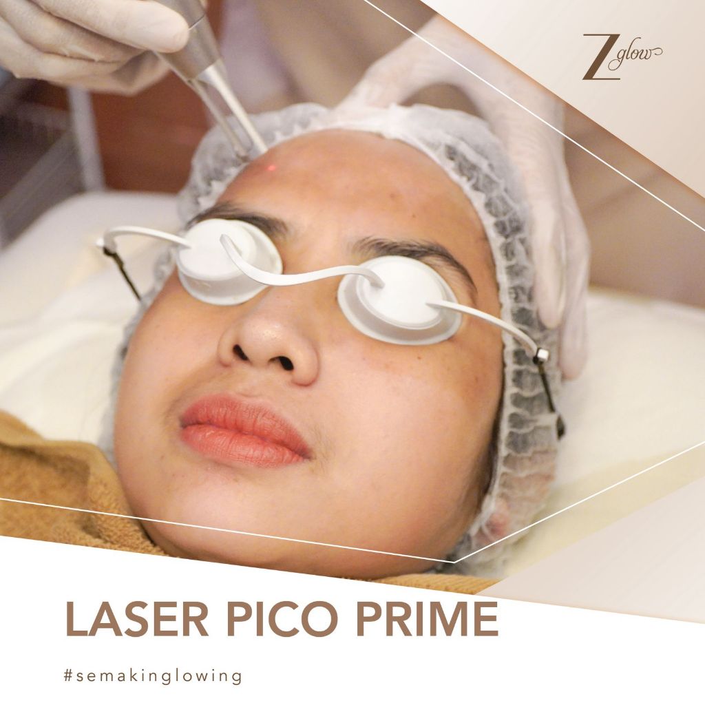 Jual ZGLOW LASER PICO PRIME GLOWING - ACNE - MELASMA | Shopee Indonesia