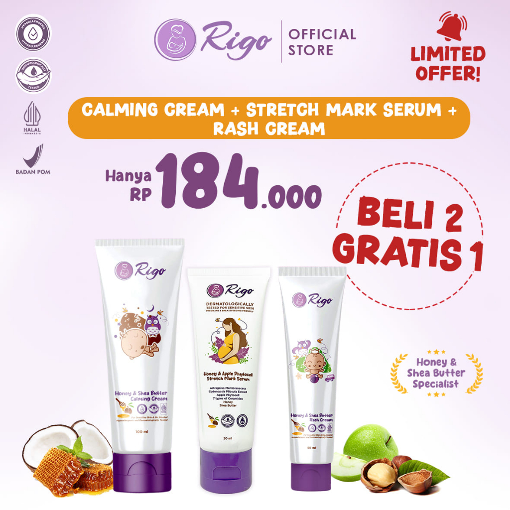 Jual Rigo Limited Edition Buy 2 Get 1 I Calming Cream 100ml + Stretch ...
