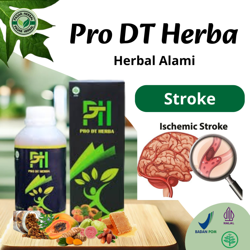 Jual Herbal Obat Stroke Ringan Obat Struk Strok Setruk Ampuh Tanpa ...