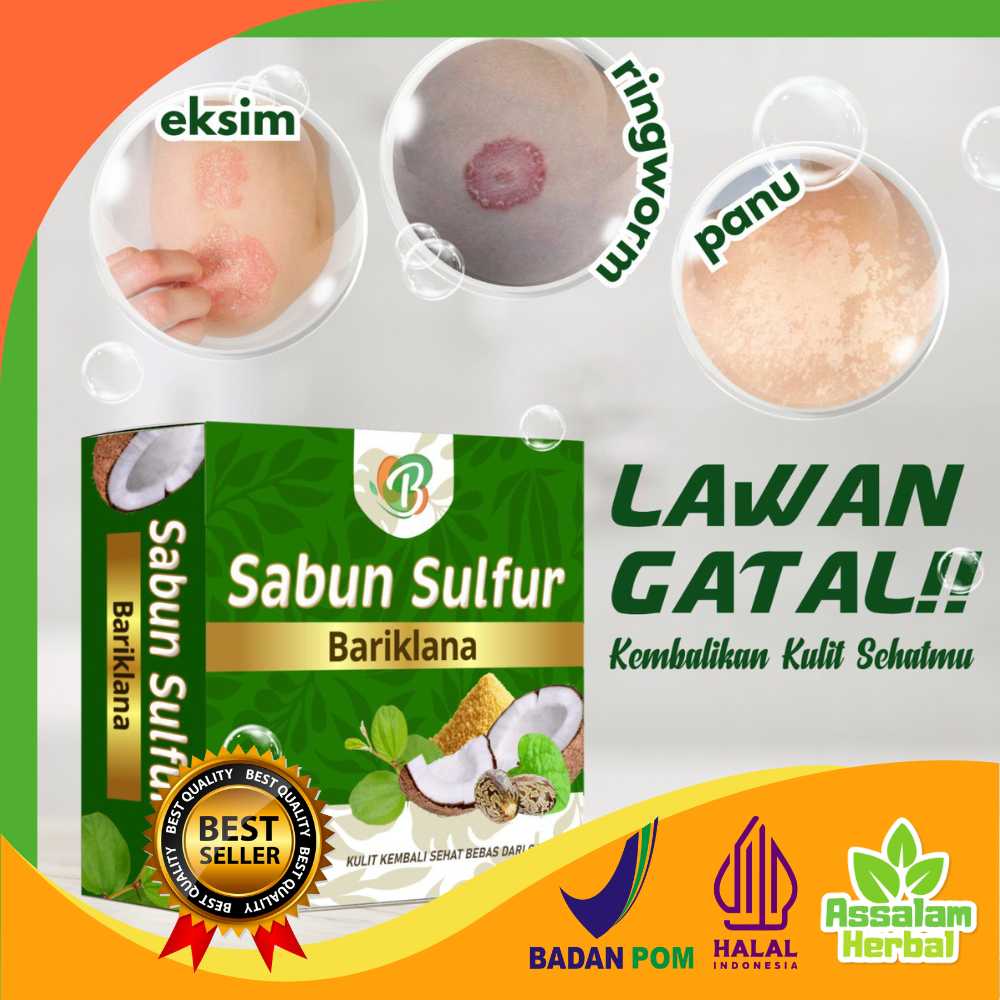 Jual SABUN GATAL Sabun Sulfur Gatal Eksim Scabies Panu Kadas Kurap ...