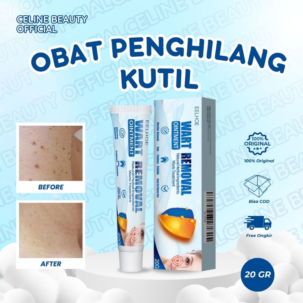 Jual Wart Removal Cream Penghilang Tahi Lalat Krim Penghilang Lalat ...