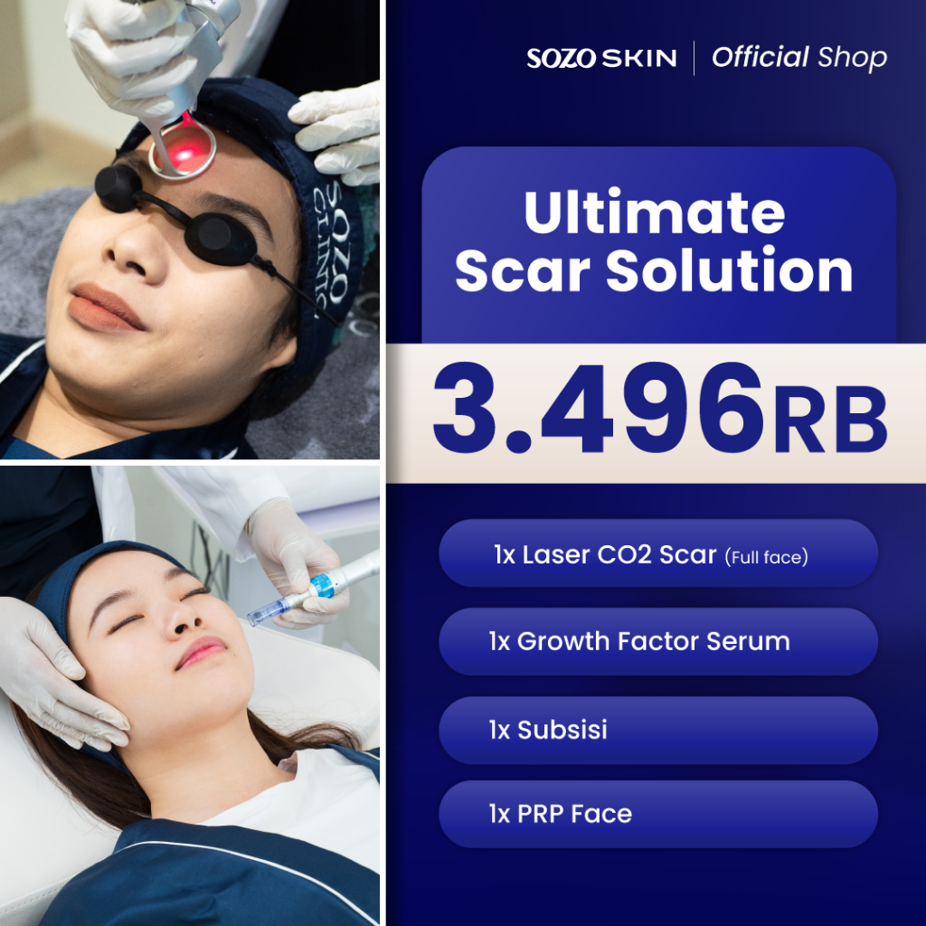 Jual SOZO SKIN Ultimate Scar Solution | Shopee Indonesia
